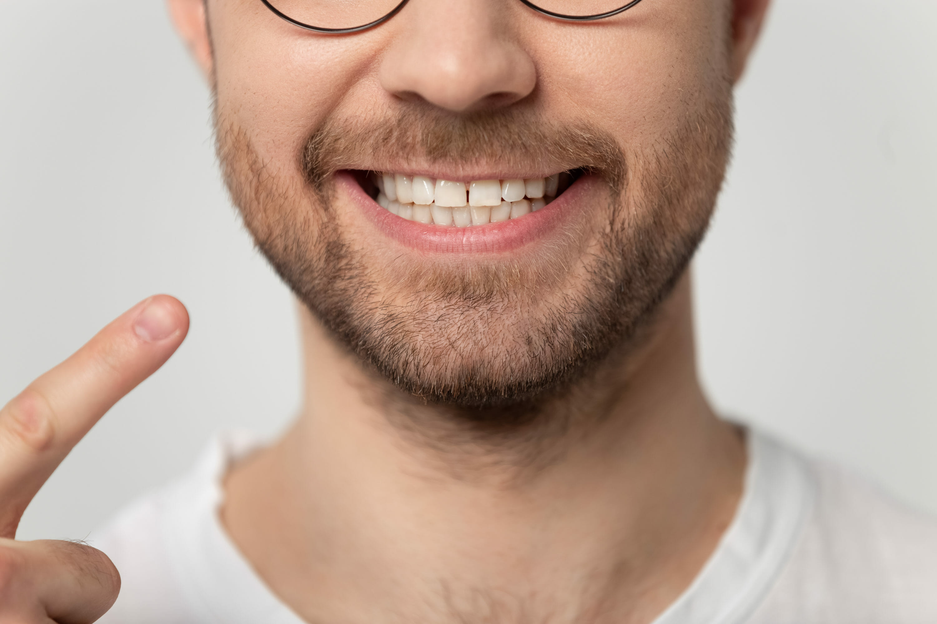 Can Hairy Tongue Be Cured? - DFW Oral Surgeons